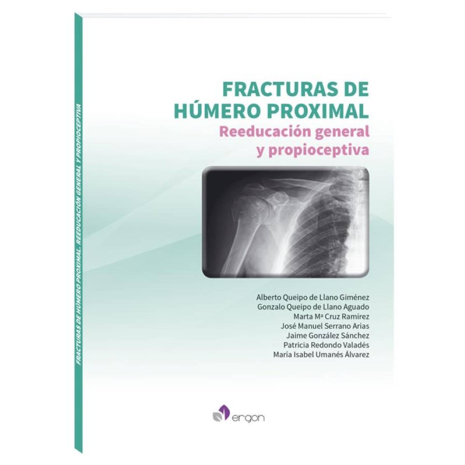 Fracturas de Húmero Proximal. Reeducación General y Propioceptiva